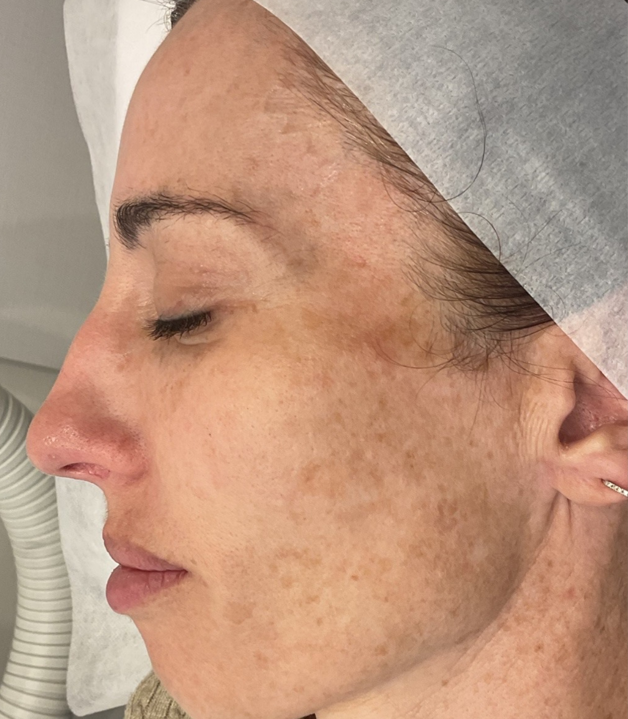 Melbourne’s Expert Skin Clinic | Facial Sculpting, Acne, Pigmentation ...